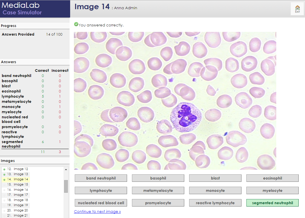 Differential Blood Count
